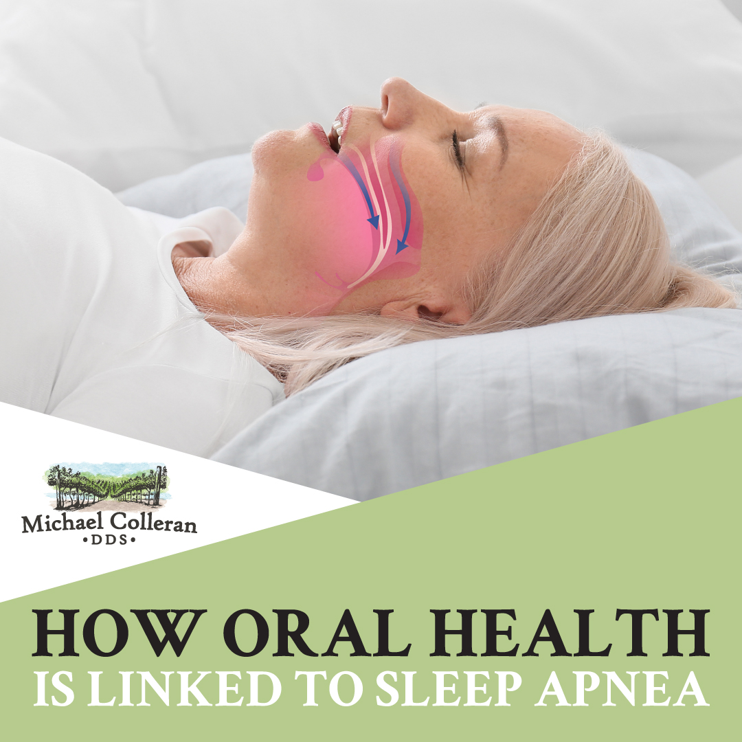 Sleep Apnea and Oral Health: The Crucial Connection in San Luis Obispo ...